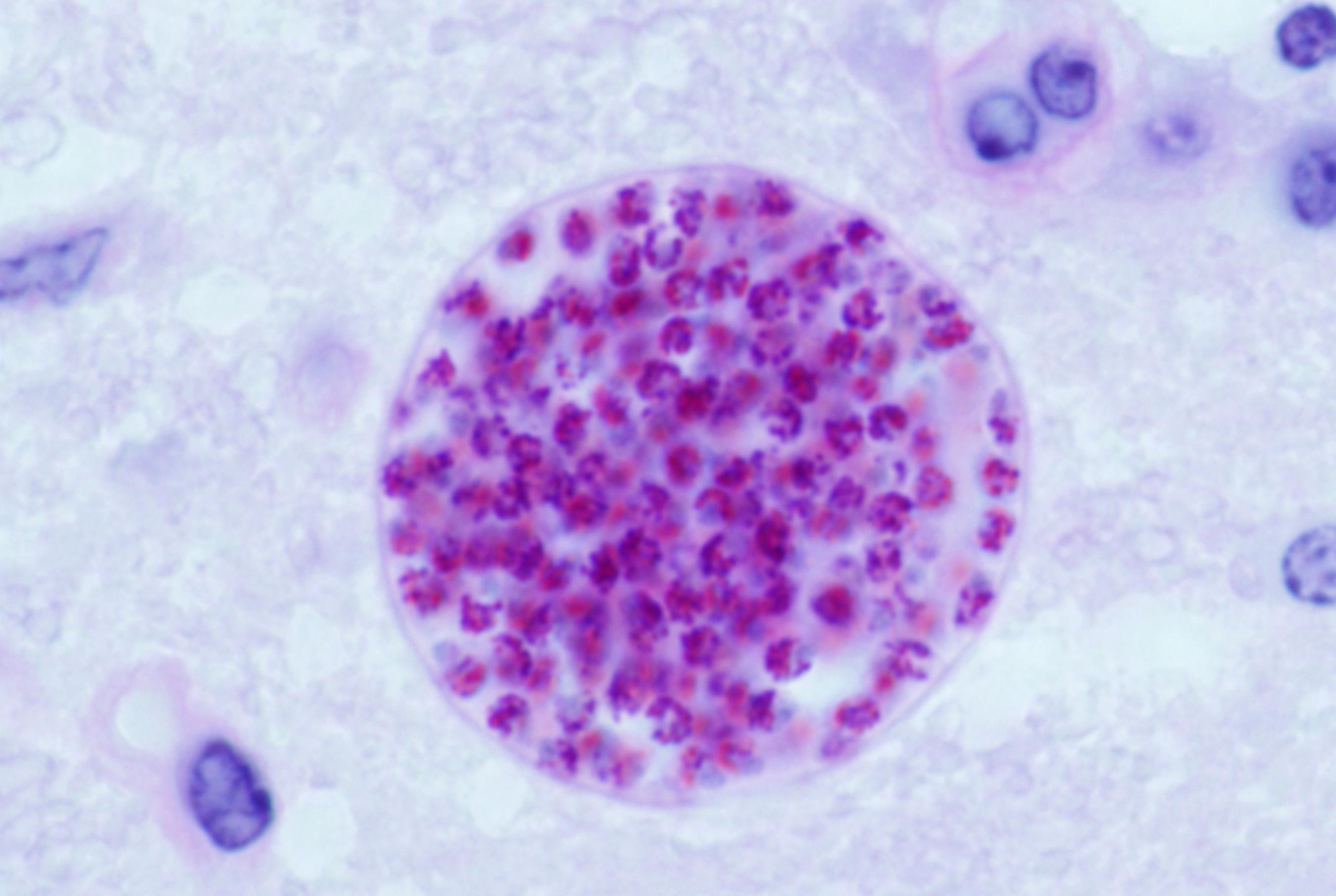 Intestinal Parasites in Cats - Symptoms and Treatment