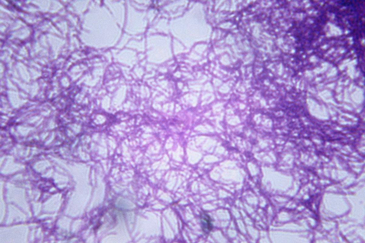 Common Sheep Diseases - Causes and Symptoms