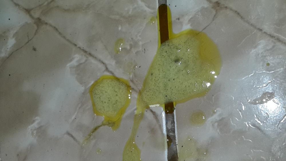 My Cat Is Throwing Up Yellow Liquid - Why Cats Vomit Yellow Bile