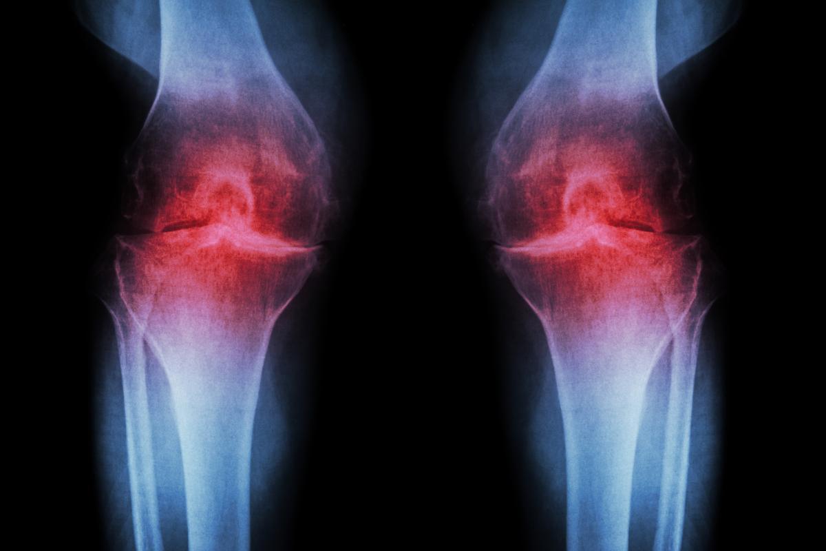 Understanding Sudden Yelps and Cries in Dogs - Causes and What to Do